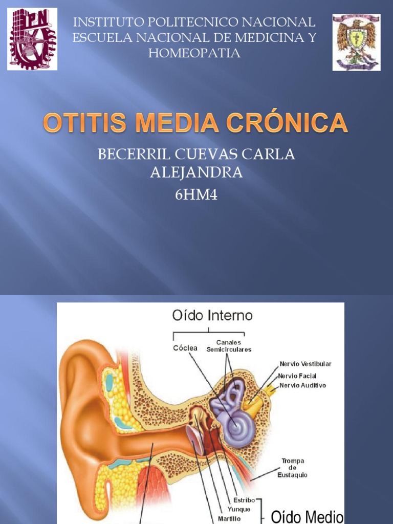 Otitis Media Cronica | Oído | Otorrinolaringología