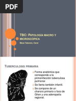 Sindrome Cavitario FISIOPATOLOGIA | PDF | Tuberculosis | Pulmón