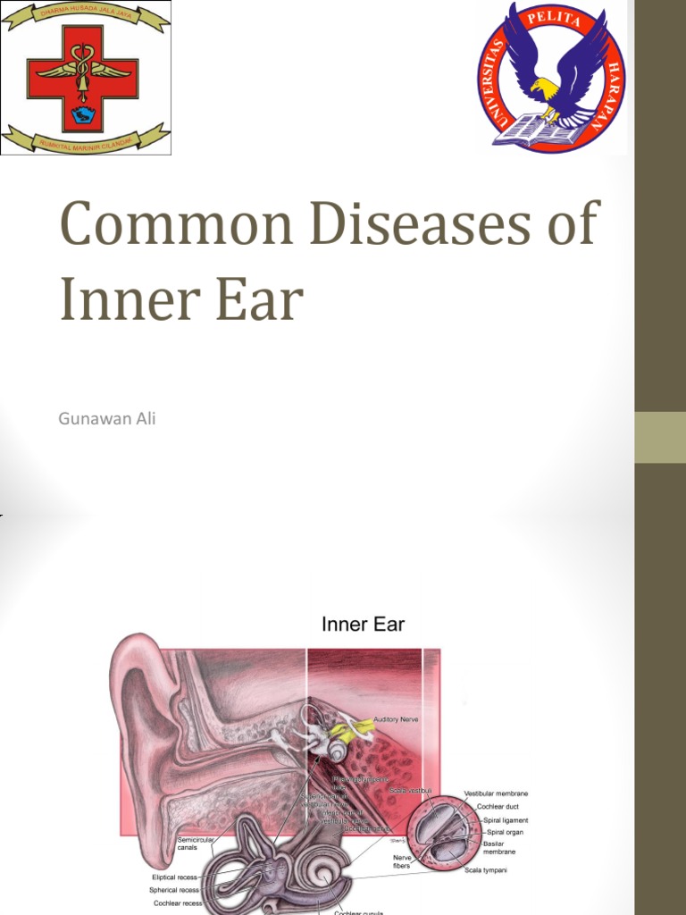 Common Diseases of Inner Ear | PDF | Vertigo | Hearing Loss