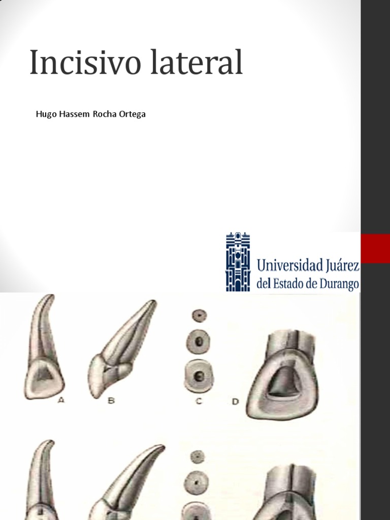 Incisivo Lateral | PDF | Estudios de idiomas extranjeros | Hogar ...