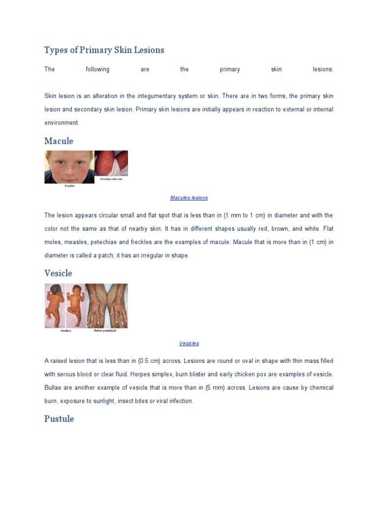 Types of Primary Skin Lesions | PDF | Dehydration | Cutaneous Conditions