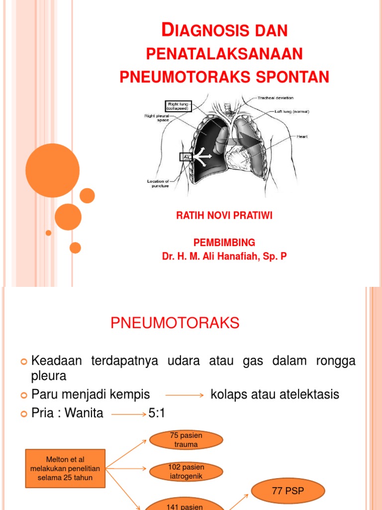 Diagnosis Dan Penatalaksanaan Pneumotoraks Spontan | PDF