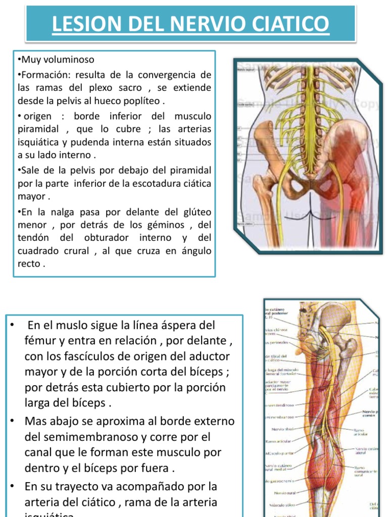 Lesion Del Nervio Ciatico | PDF | Tejido suave | Anatomía humana