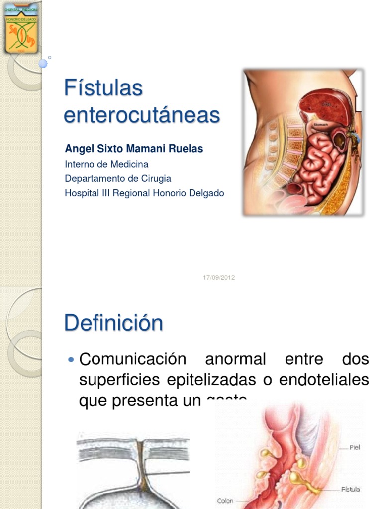 Fístulas Enterocutáneas | PDF | Cirugía | Especialidades Medicas