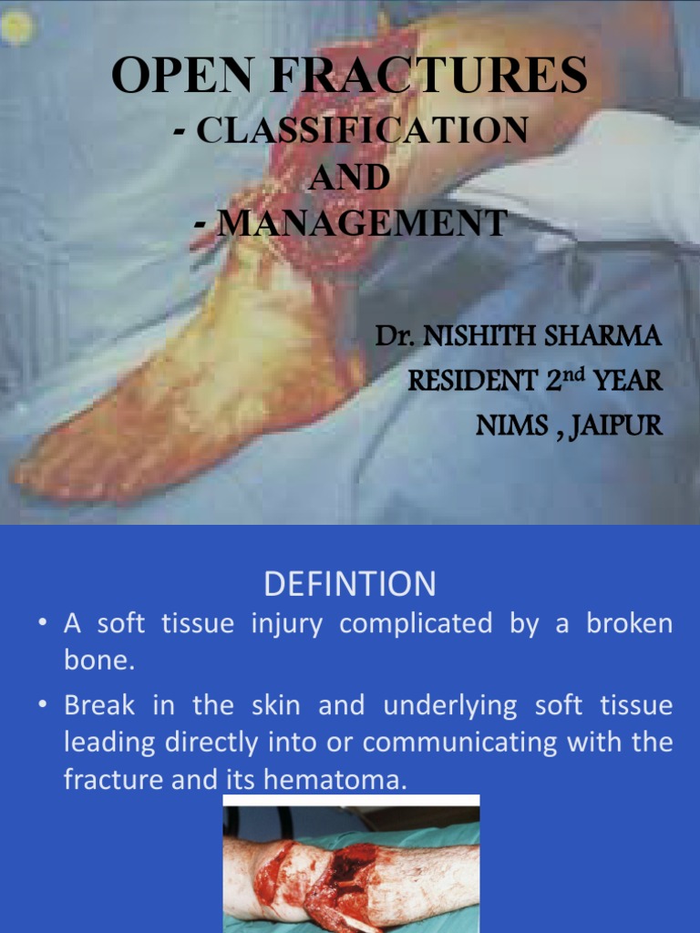 OPEN FRACTURES Final Dr. Nishith Sharma | PDF | Wound | Shock (Circulatory)
