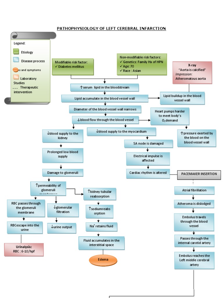 Pathophysiology of Stroke | PDF | Atheroma | Cardiac Muscle