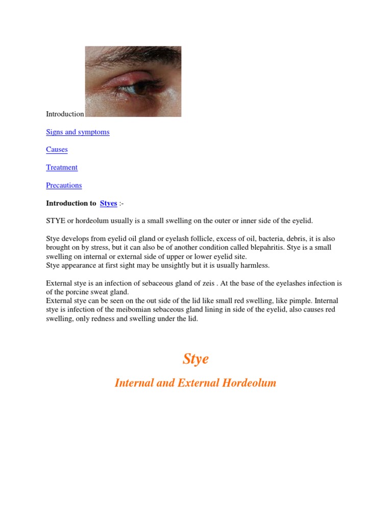 Introduction To STYE | PDF | Health Sciences | Medicine