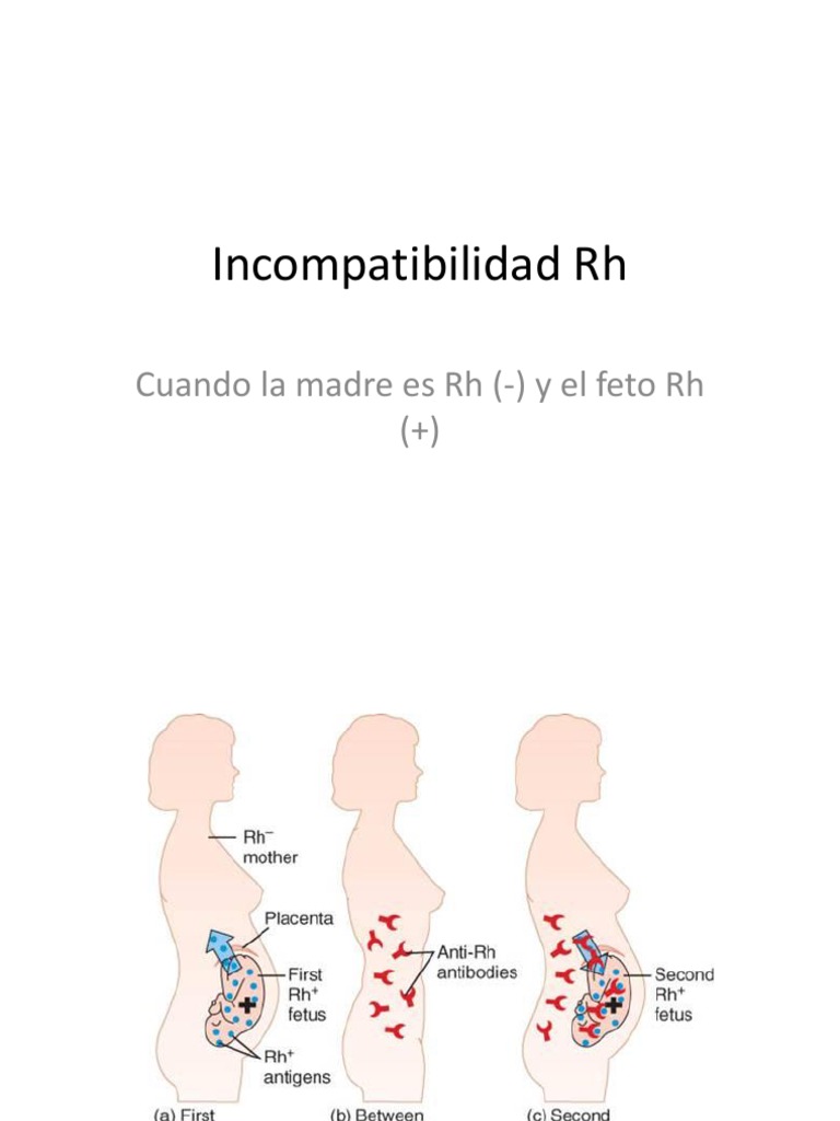 Incompatibilidad RH Neonatología | PDF | Especialidades Medicas ...