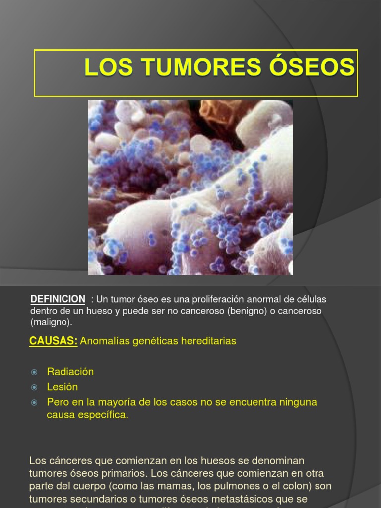 Tumores Óseos: Causas y Diagnóstico | PDF | Neoplasias | Cáncer