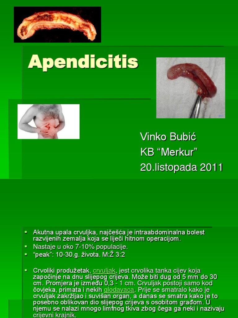 Apendicitis | PDF
