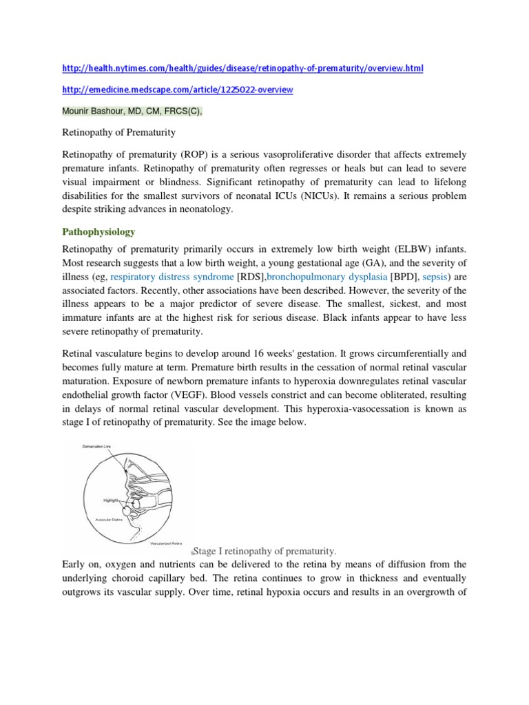 Retinopathy of Prematurity Guide | PDF | Preterm Birth | Medical ...