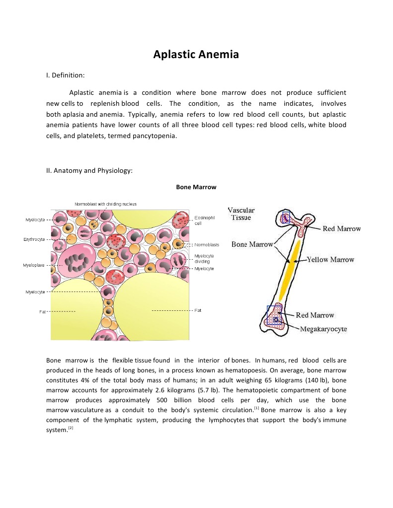Aplastic Anemia | PDF | Bone Marrow | Bone