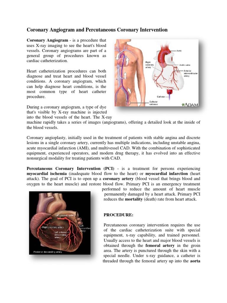 A Comprehensive Guide to Coronary Angiography and Percutaneous Coronary ...