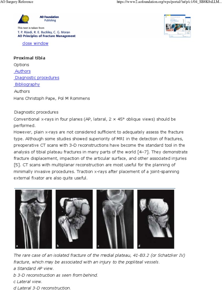 Proximal Tibia AO | PDF | Magnetic Resonance Imaging | Injury