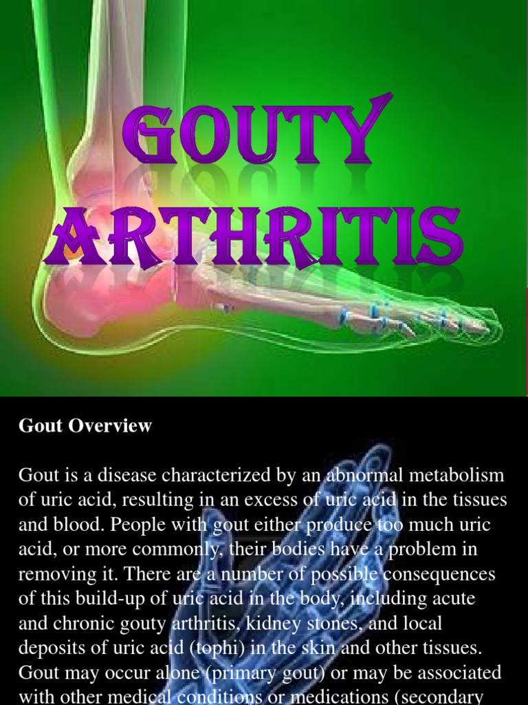 Gouty Powerpoint | Gout | Arthritis