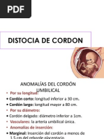 Distocia Funicular: Definición y Evaluación | PDF | Parto | Feto