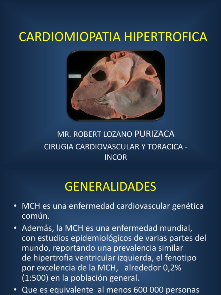 MIOCARDIOPATIA HIPERTROFICA OBSTRUCTIVA | Enfermedades cardiovasculares ...