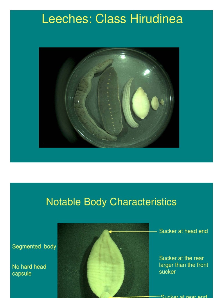 Leeches | PDF | Eye | Color