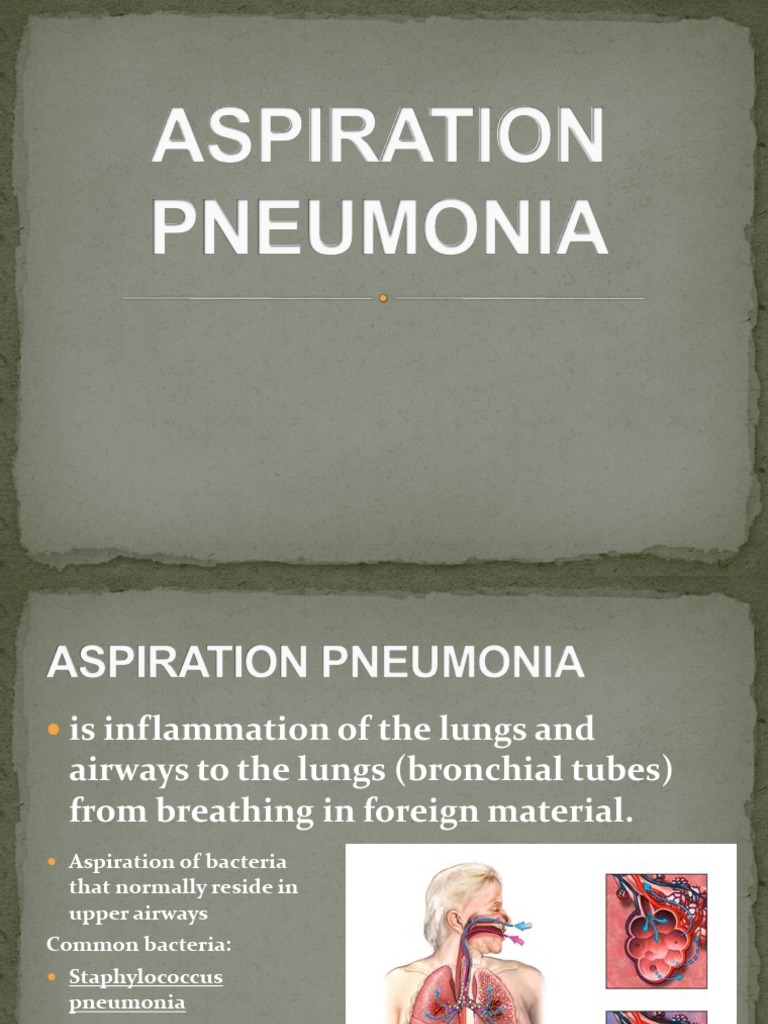 Understanding Aspiration Pneumonia | PDF | Respiratory Tract | Pneumonia