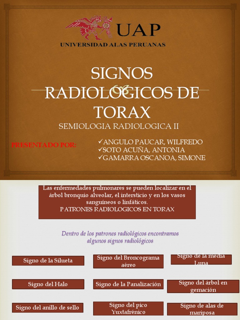 Signos Radiologicos de Torax - Exponer | PDF | Pulmón | Ct Scan