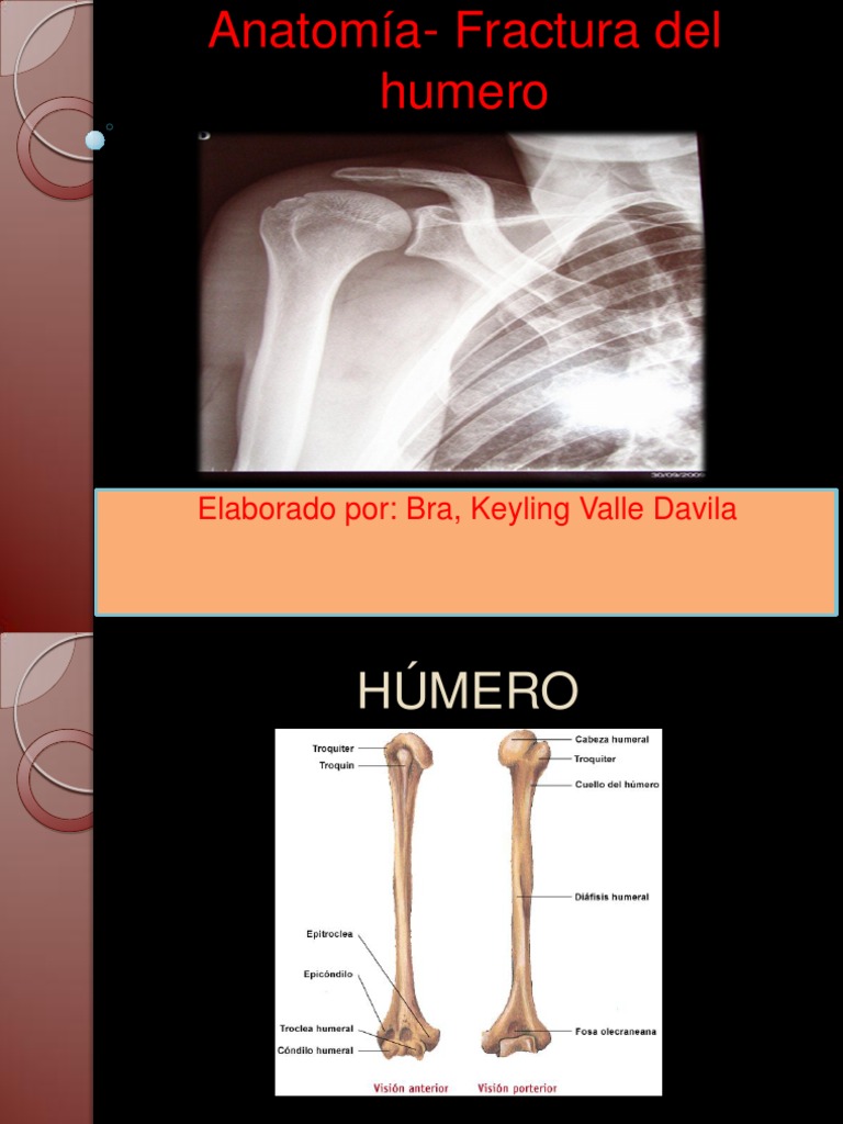 Anatomia y Fractura Humero | PDF | Sistema musculoesquelético ...