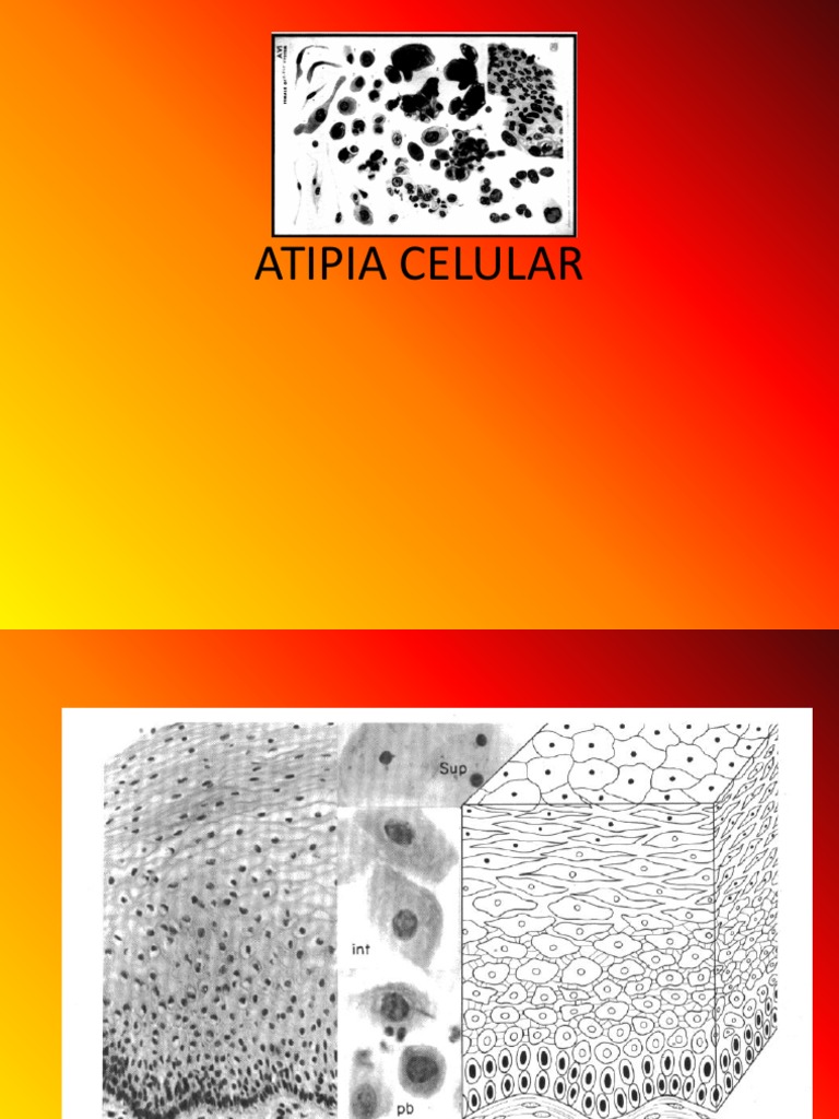 Atipia Celular Exposicion | Epitelio | Biología Celular)