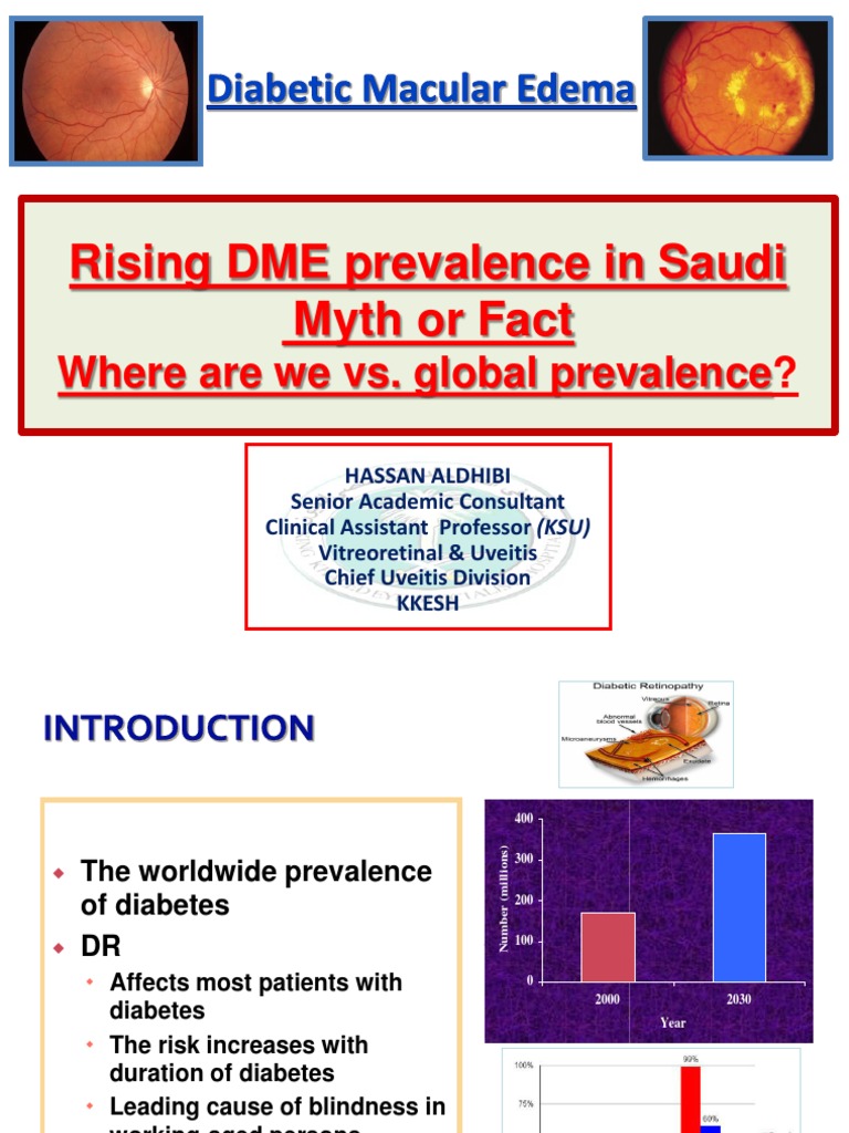 DME in Saudi Arabia - Myth or Fact | PDF | Visual Impairment | Diabetes ...
