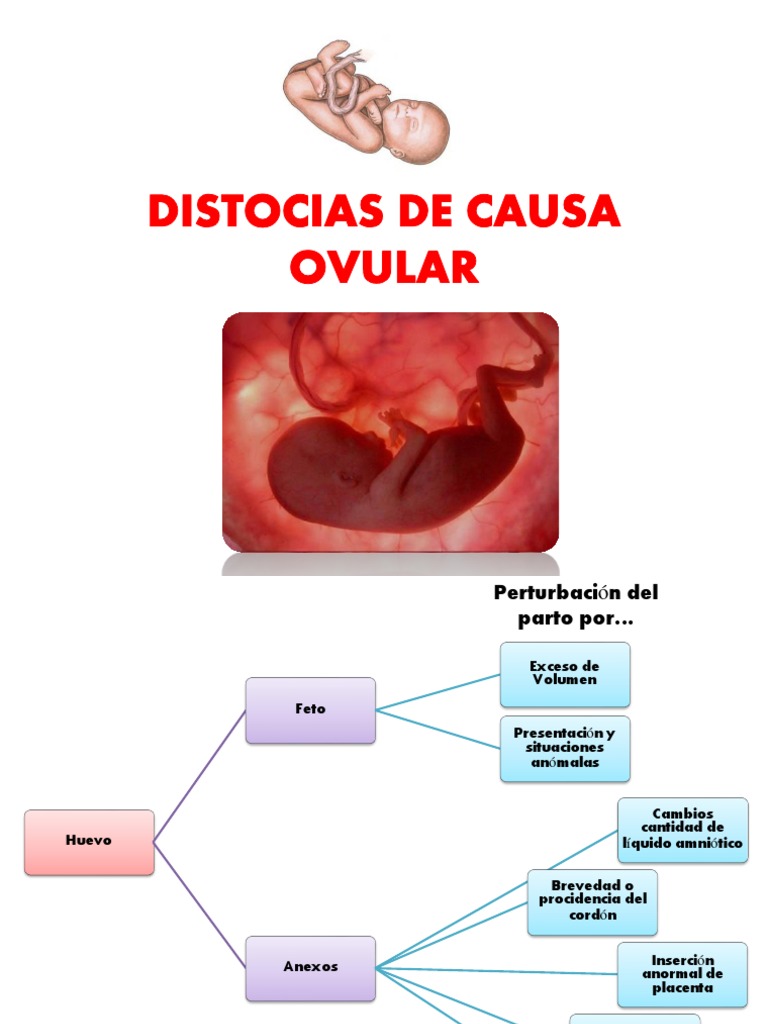 Distocia de Causa Ovular | Parto | Pelvis