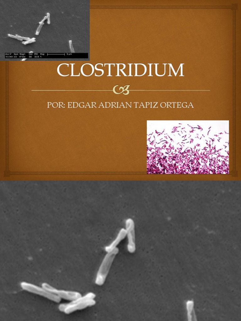 Clostridium Exposicion | PDF | Diarrea | Microbiología