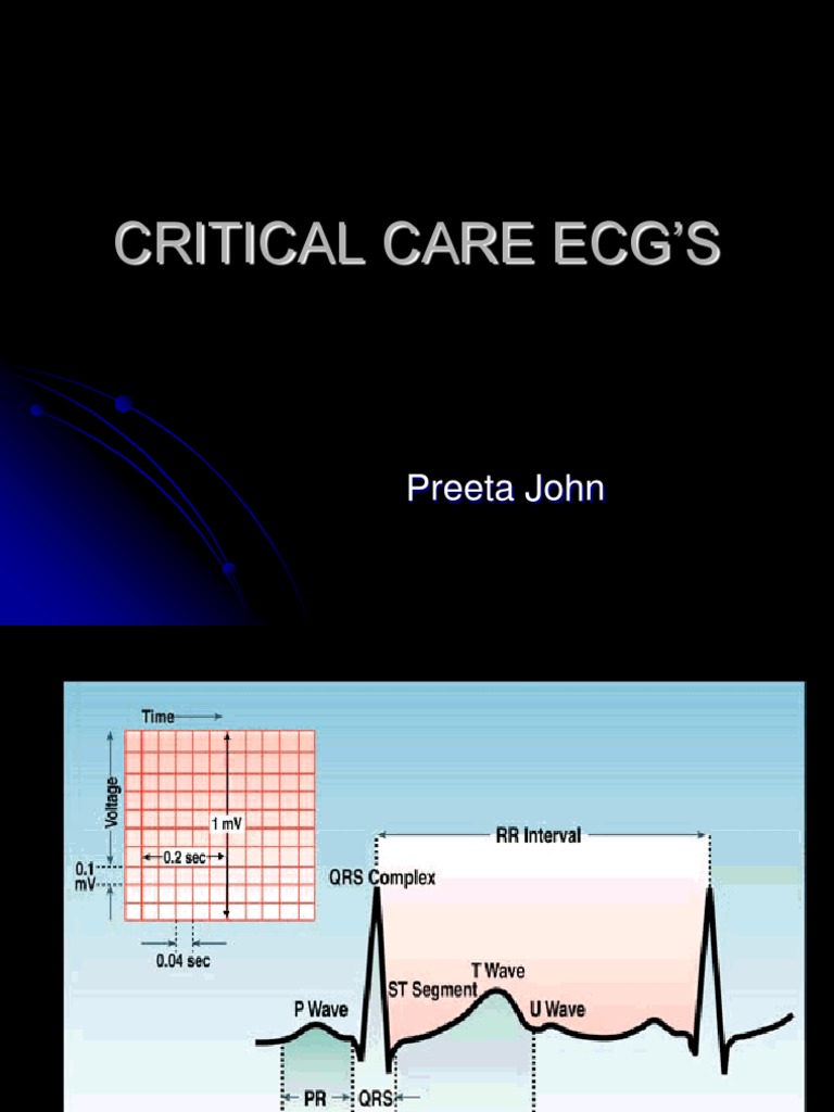 Critical Care ECG Interpretation: A Guide to Understanding Common ...