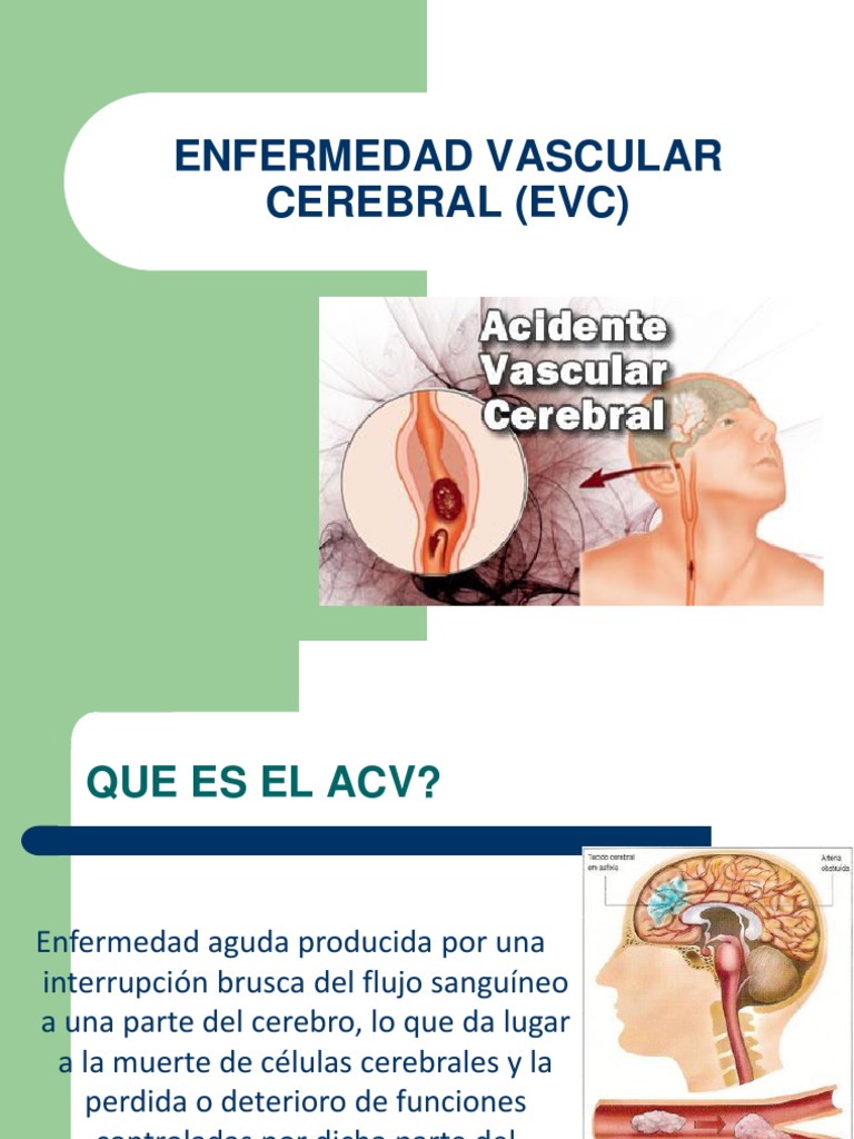 Enfermedad Vascular Cerebral (Evc) | PDF | Carrera | Especialidades Medicas