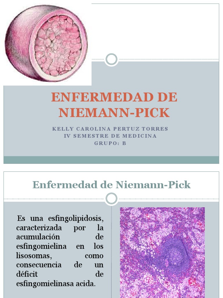 Enfermedad de Niemann-pick | Enfermedades y trastornos | Especialidades ...