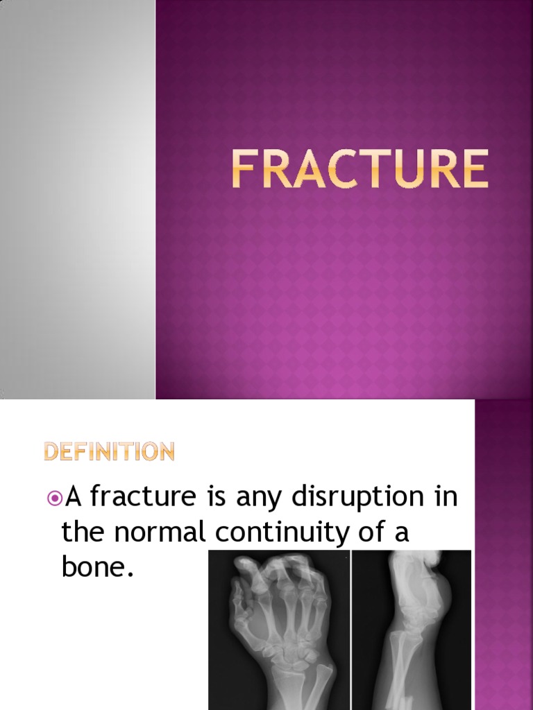 Fracture | PDF | Bone | Osteoporosis