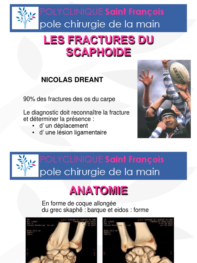 Fractures du Scaphoïde : Diagnostic et Traitement | PDF | Appareil ...