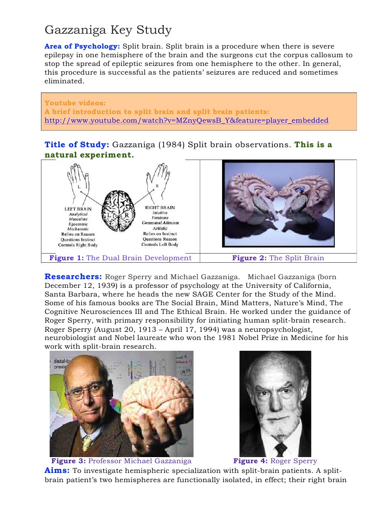 Roger Sperry Split Brain
