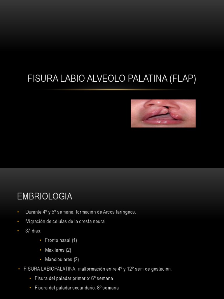 Fisura Labio Alveolo Palatina: Embriología y Tratamiento | PDF