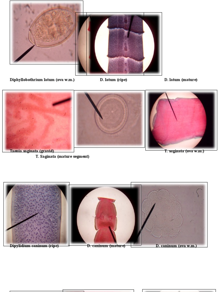 Parasitology Pictures | PDF