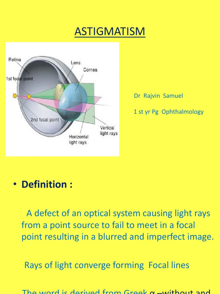 Astigmatism | PDF | Lens (Optics) | Contact Lens