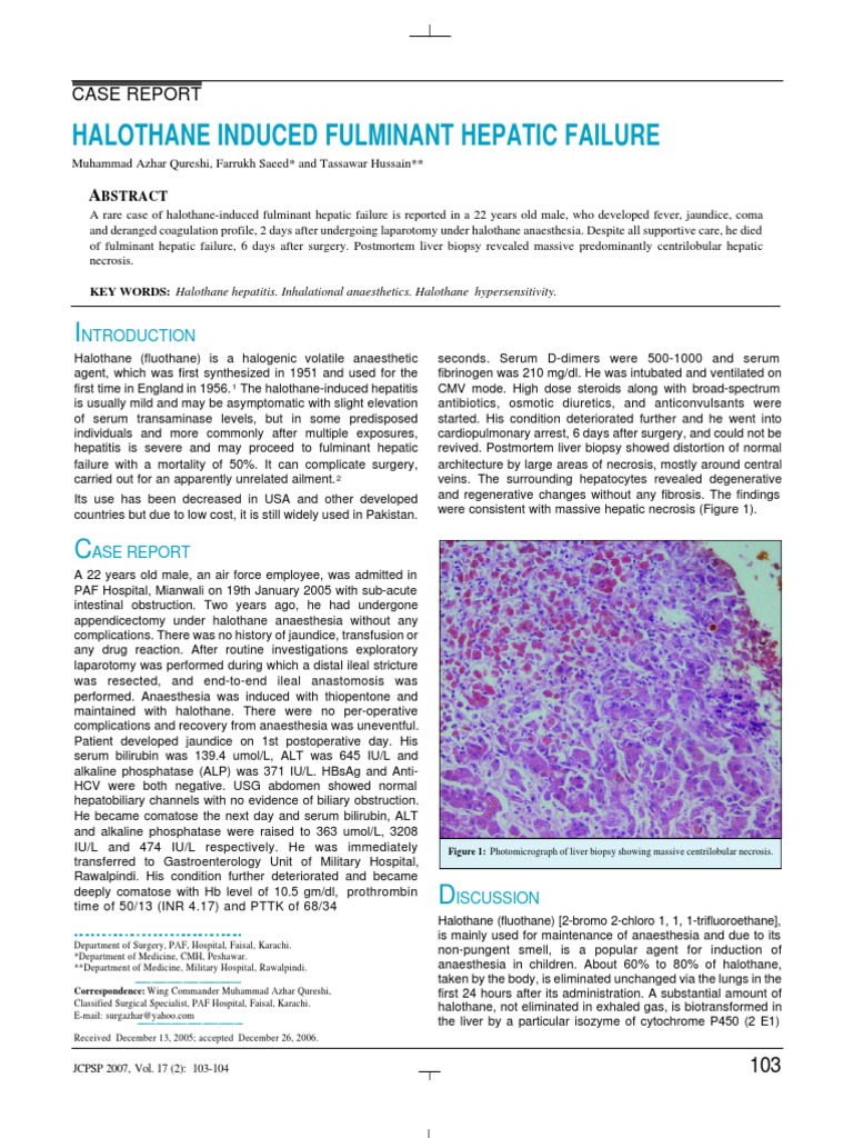 Halothane Induced..Cr | PDF | Hepatitis | Liver