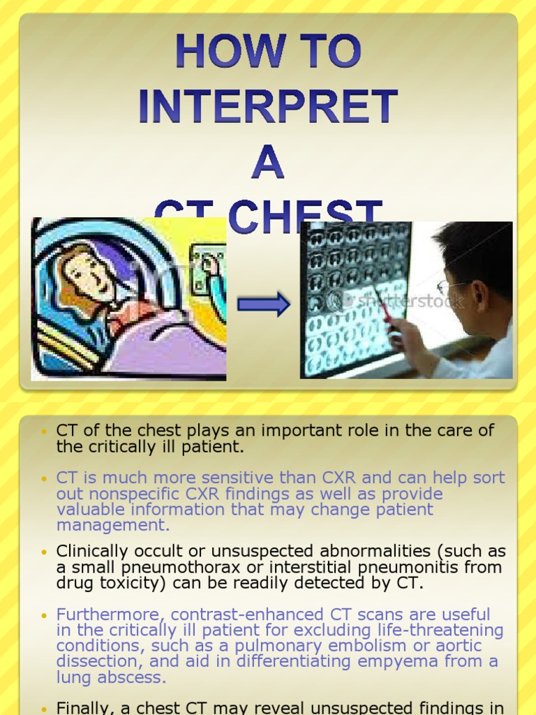 How To Interpret CT Chest.k | PDF | Lung | Aorta