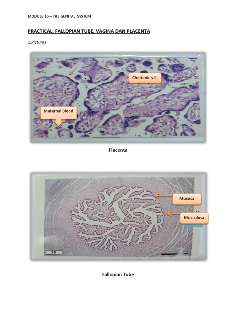 Histology of Fallopian Tube, Vagina and Placenta | PDF