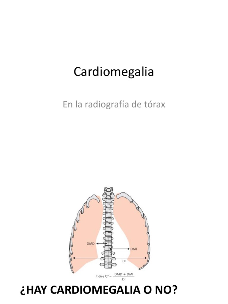 Evaluación de Cardiomegalia en RX | PDF