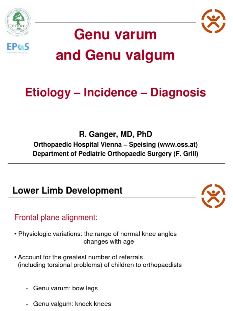 Genu Varum and Genu Valgum Ganger 20.05.2011 | PDF | Human Leg ...