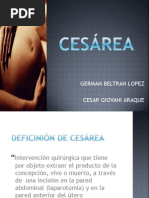 Tipos de Incisiones en Cesárea | PDF | Parto | El embarazo