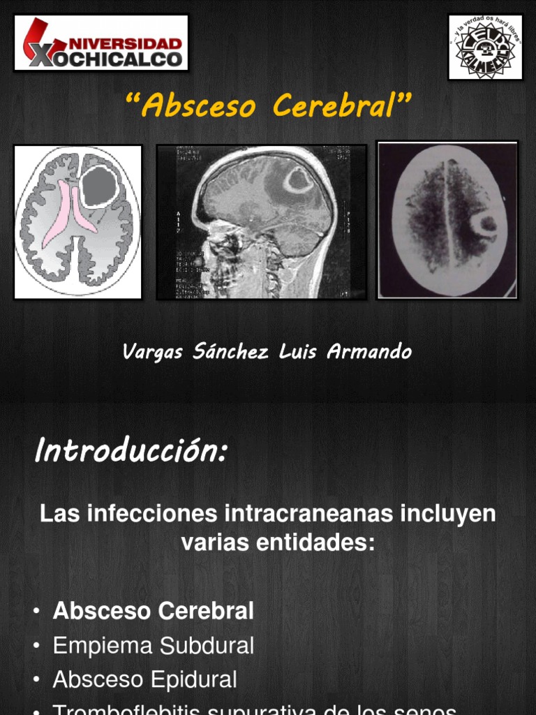 Absceso Cerebral | PDF | Enfermedades y trastornos | Especialidades Medicas