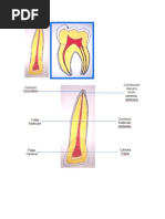 Técnicas Ápico-Coronales en Endodoncia | PDF | Ramas de Odontología