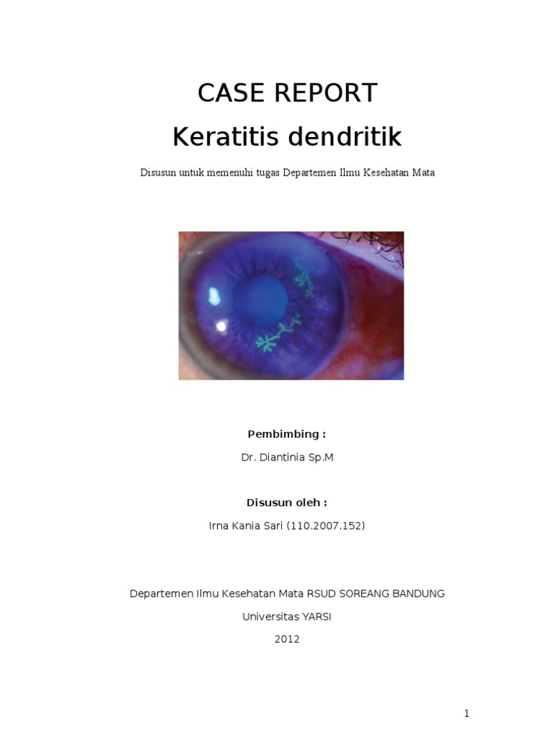 Case Report Keratitis Dendritik | PDF