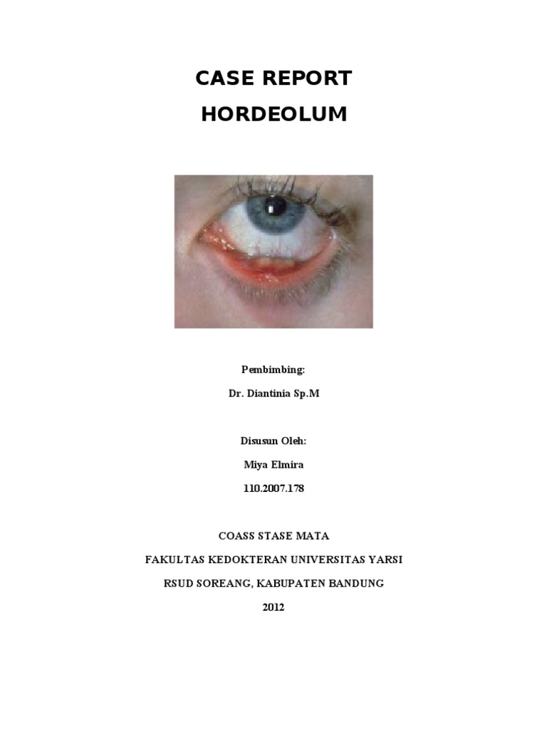 Case Report Hordeolum | PDF