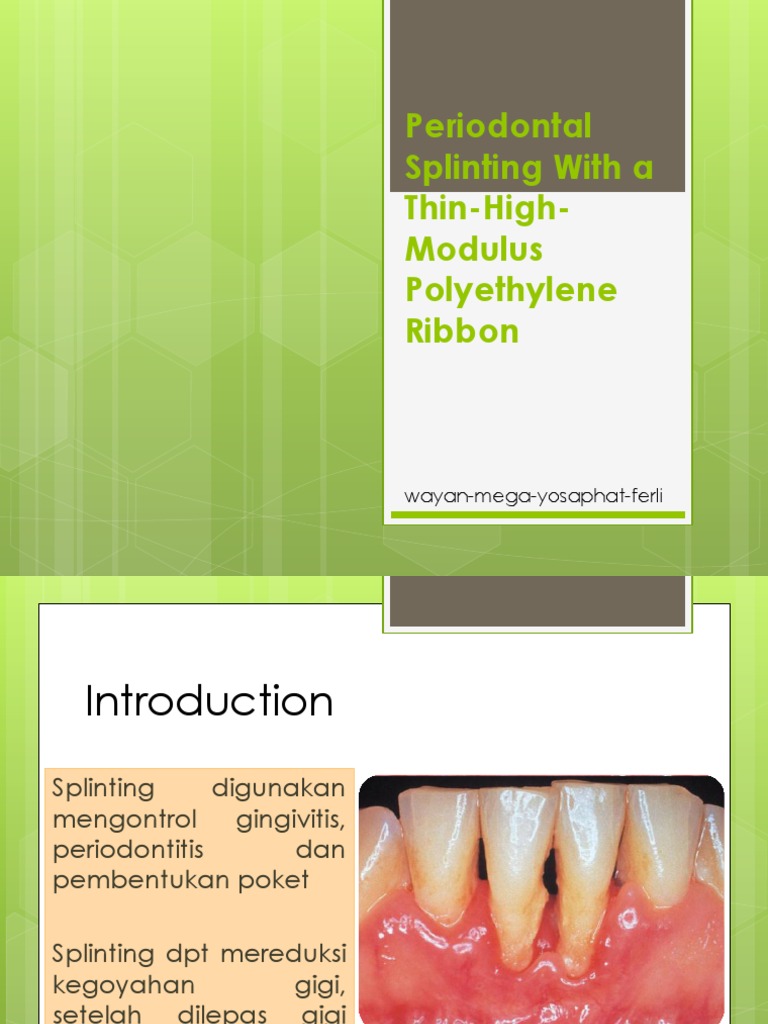 Periodontal Splinting With A | PDF