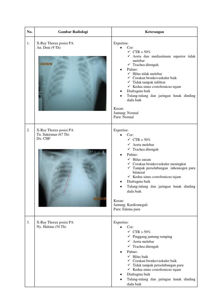 Radiologi Expertise Thorax | PDF